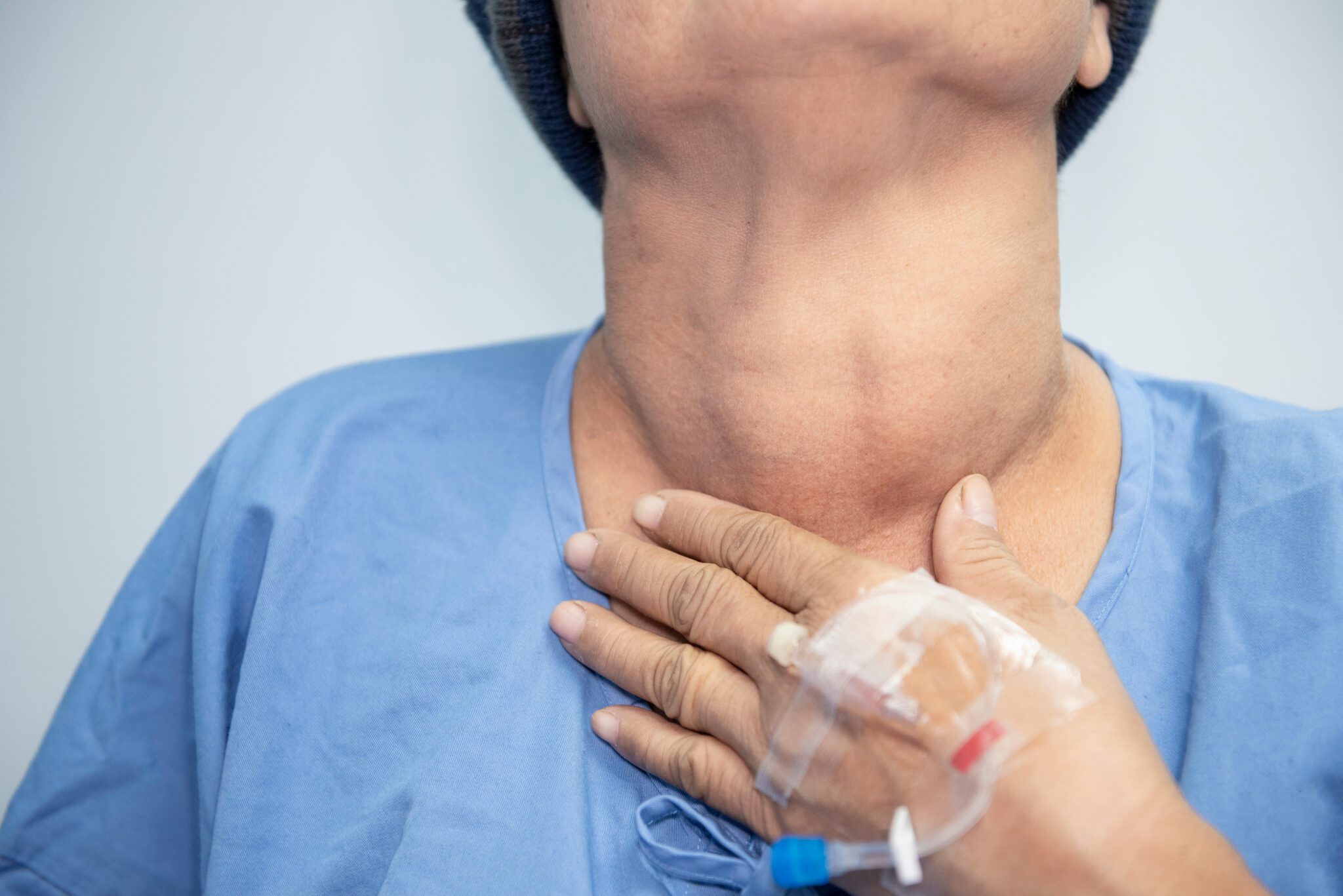 Thyroidectomy in McKinney, Texas - Methodist McKinney Hospital